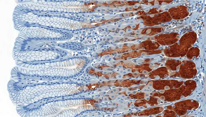 Immunohistochemistry (IHC) - Creative Biolabs